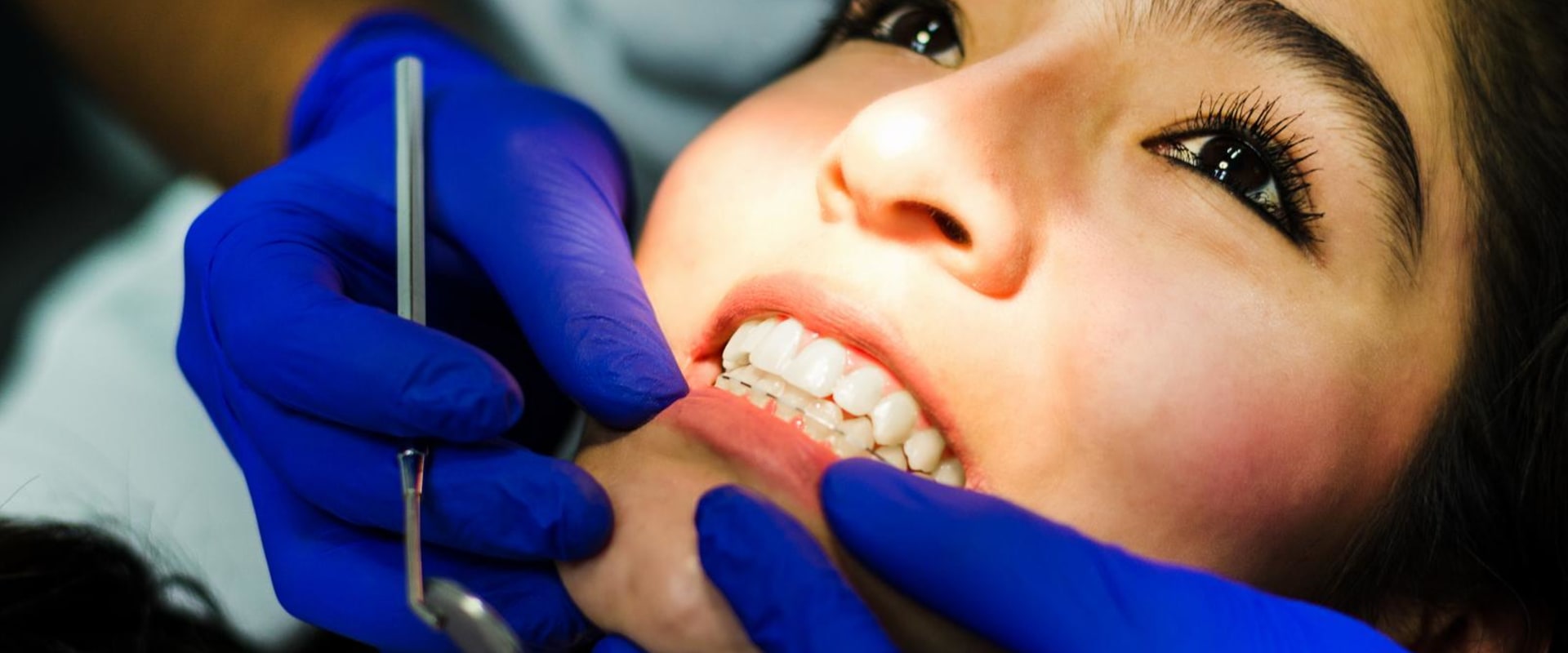 Achieve A Picture-Perfect Smile With Porcelain Veneers In Conroe, TX ...